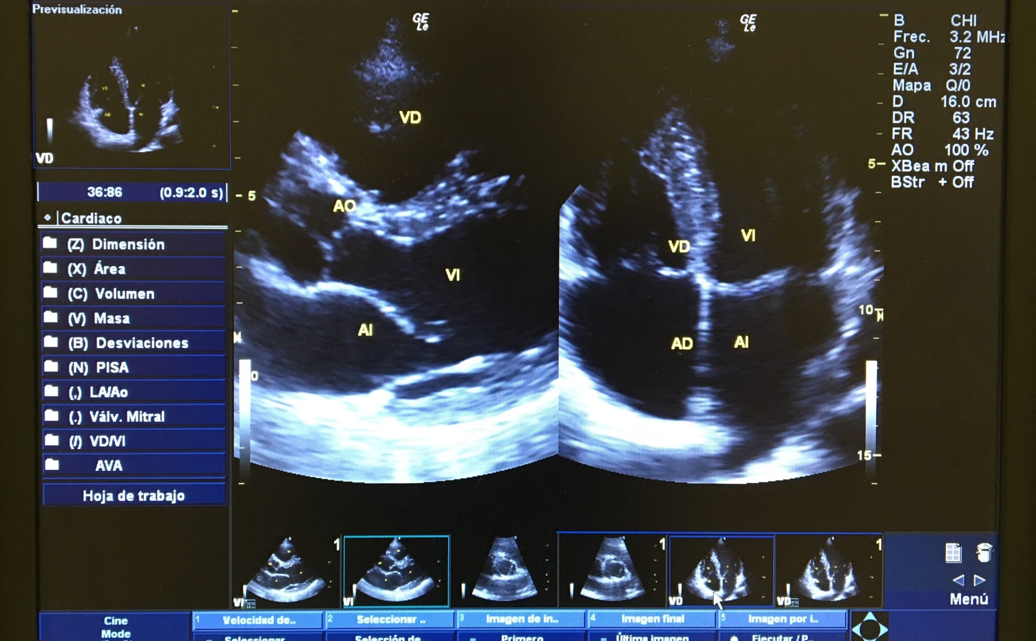 Cardio Tests – Dr. Fernando de la Guía