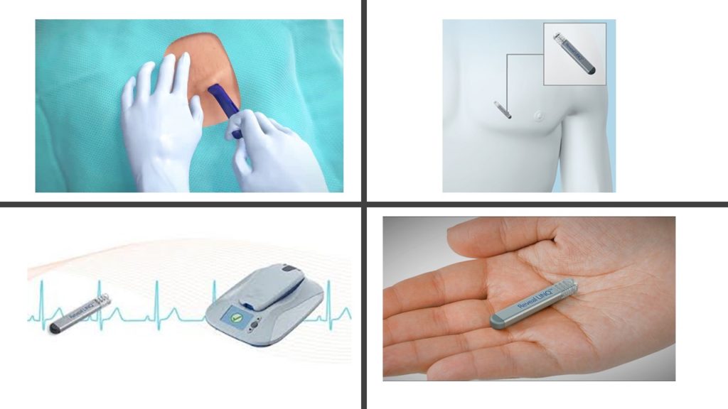 Cardio Tests – Dr. Fernando de la Guía